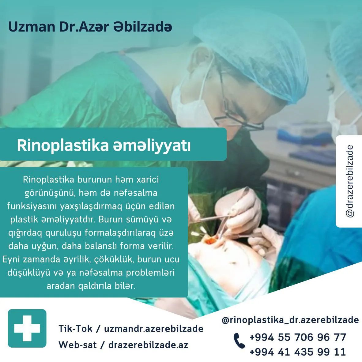 Rinoplastika (burun əməliyyatı) - Daxili Kreditlə